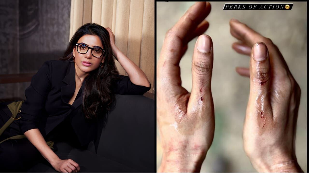 'Perks of Action': Of Samantha, myositis, and stunts