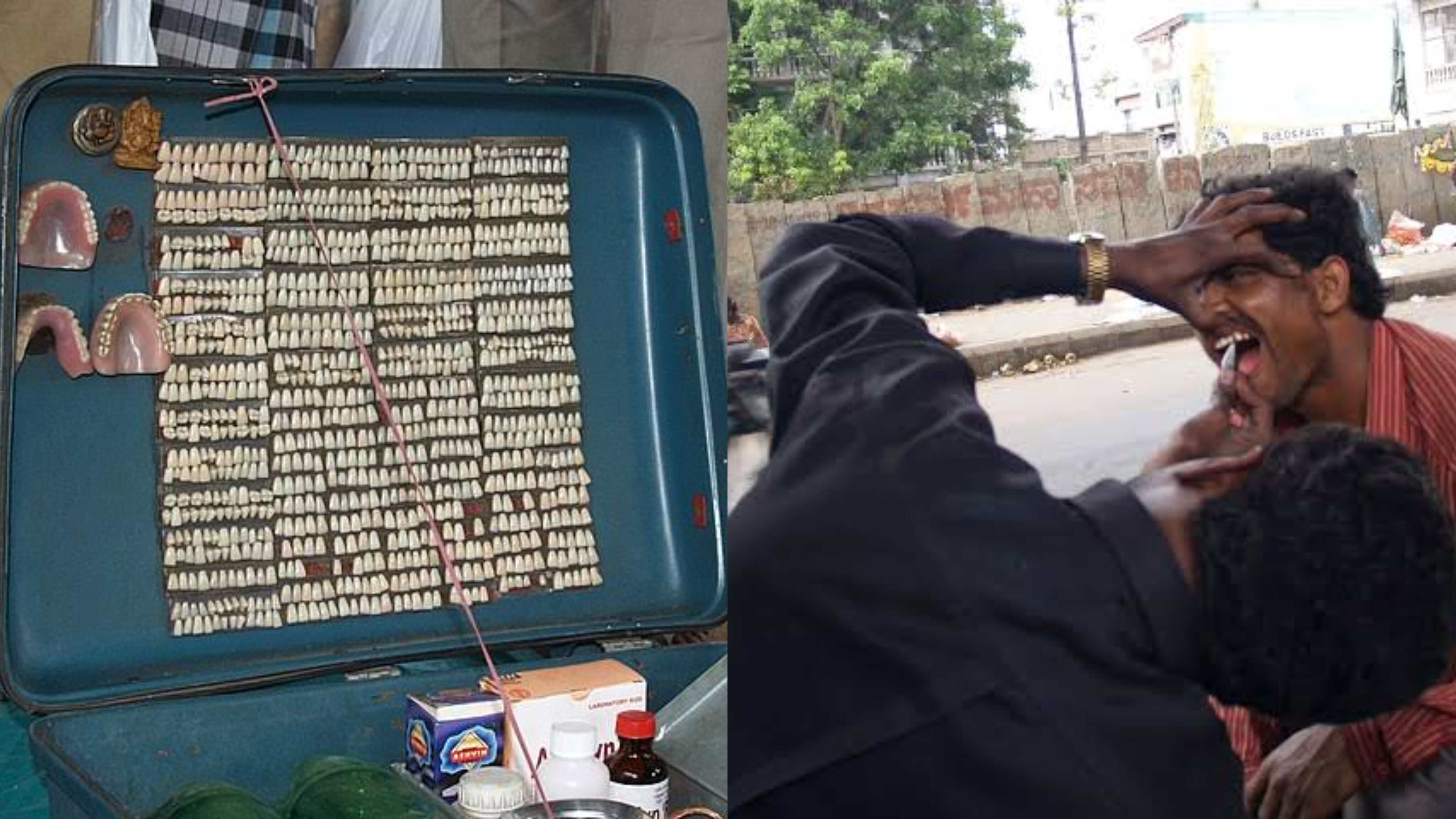 Inflamed gums, lost teeth: The hidden dangers of unqualified dentists ...